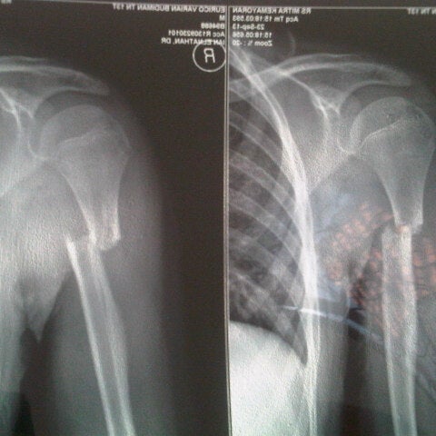 Ruang Radiologi RS Tria Dipa - , Jakarta - Jakarta