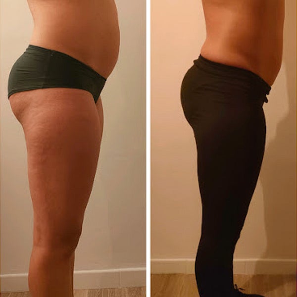 Selsabil -Drainage lymphatique Manuela Shala/ Renata Franca - Maderotherapie Glamourousbody.sk ...